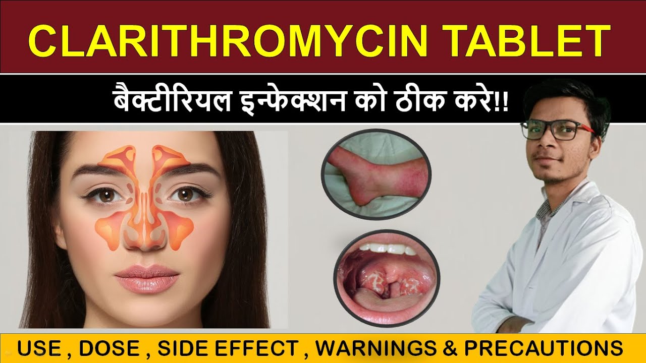 clarithromycin 500 mg | clarithromycin 250 | claribid 500 | clarinova ...