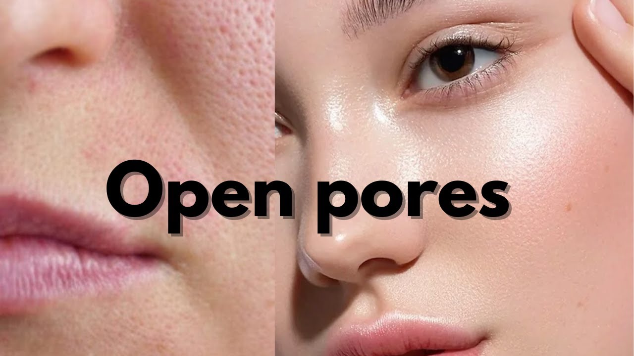 Open Pores remedy at home | How to treat Large open pores ...