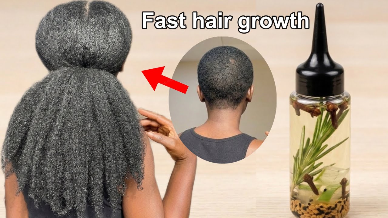 FAST HAIR GROWTH OIL /VIRAL HAIR GROWTH OIL ON THE INTERNET/ FAST HAIR ...