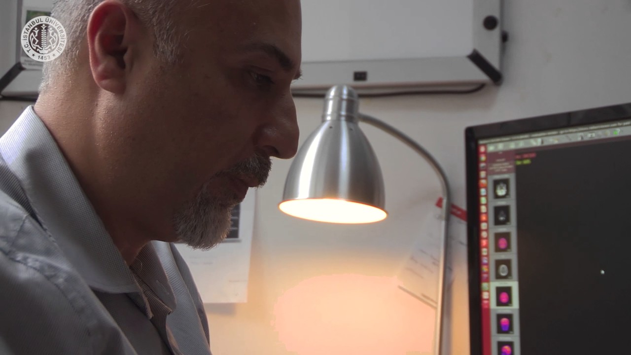 Doç. Dr. Başar Bilgiç Parkinson Hastalığı Hakkında İÜWEB TV'ye ...