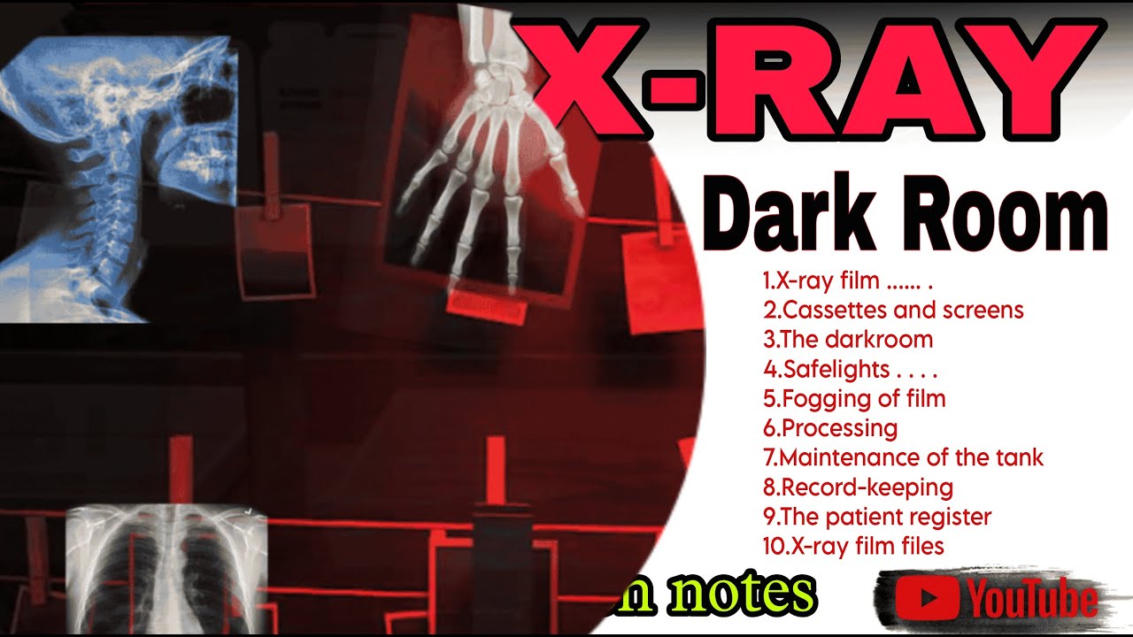 X-ray Dark Room, cassette, developer tank, X-ray film notes - YouTube