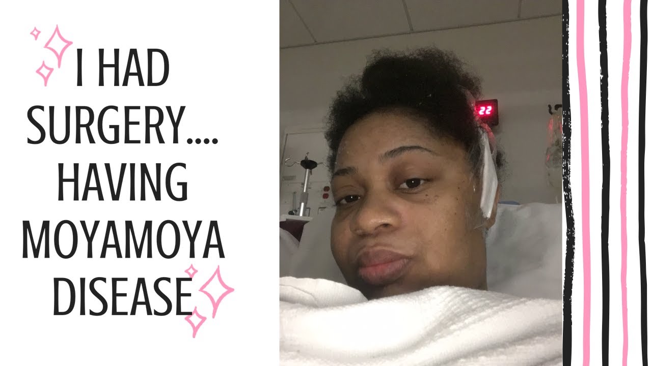 My Surgery of Moya Moya disease|2019 - YouTube