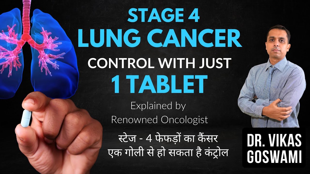 4th stage Lung Cancer - 1 Tablet treatment - Dr. Vikas Goswami ...