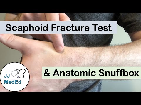 Scaphoid Fracture Test (Clinical Exam) and the Anatomic Snuffbox