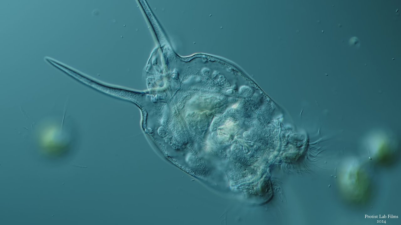 Various Rotifer - Collotheca, Brachionus, Anuraeopsis, Trichocerca ...