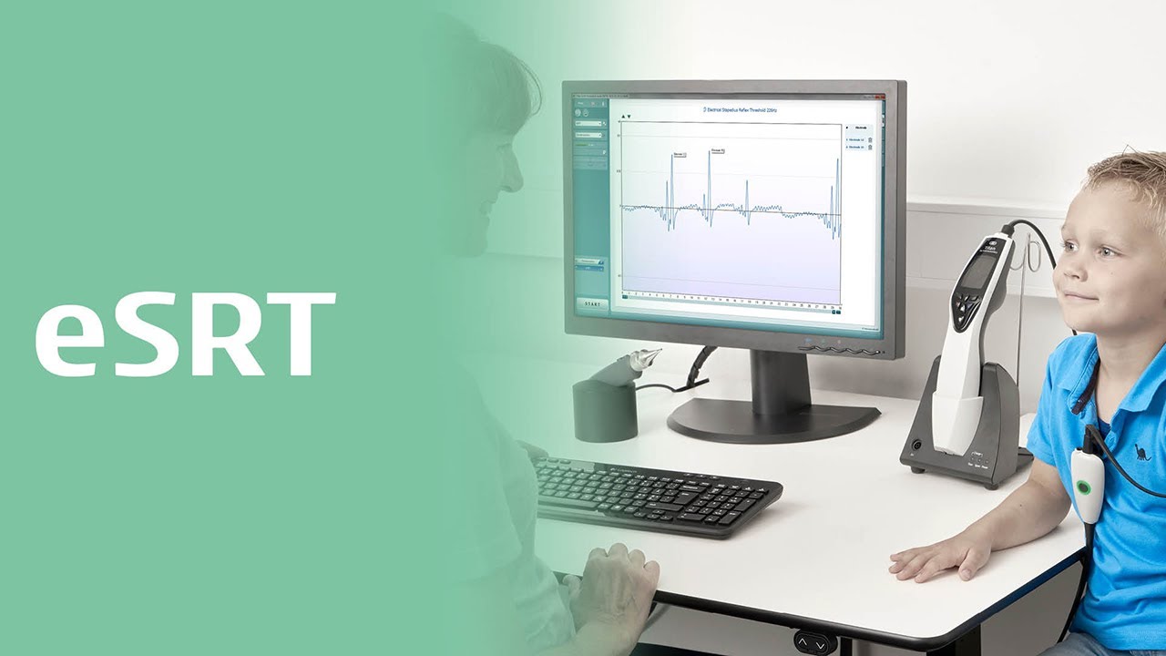 Electrically Evoked Stapedius Reflex Threshold (eSRT) - YouTube