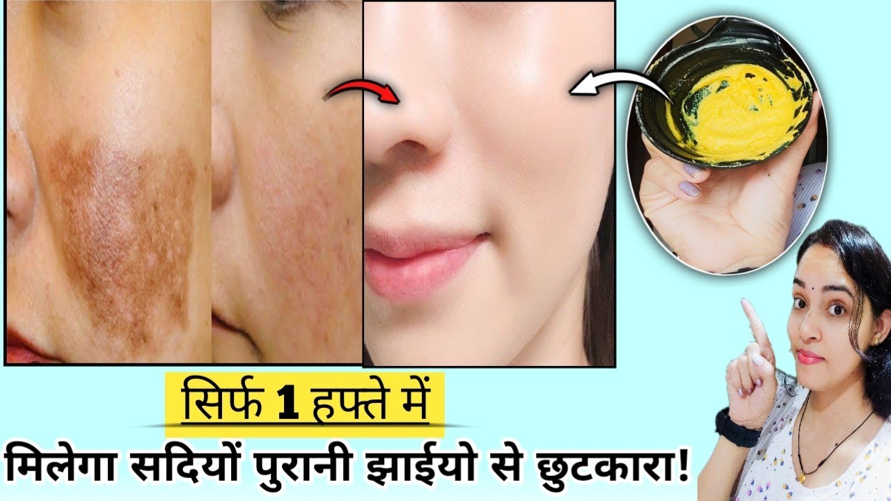👆Face mask for pigmentation and glowing skin 7 days challenge |mask for ...
