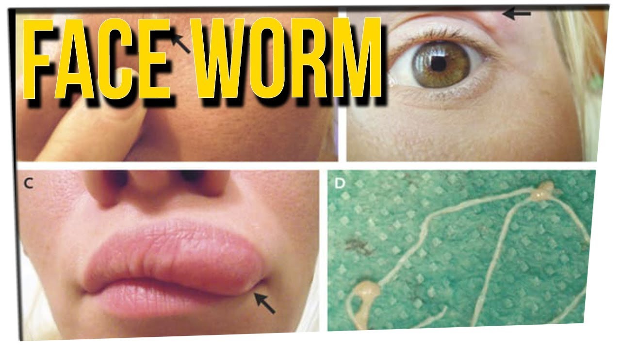 WS - Woman Finds Worm In Her Face ft. DavidSoComedy & Noah Fleder - YouTube