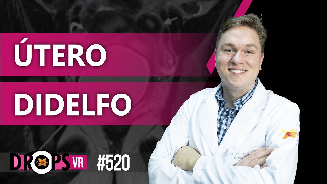 ÚTERO DIDELFO NA RESSONÂNCIA MAGNÉTICA / VOCÊ RADIOLOGISTA - YouTube
