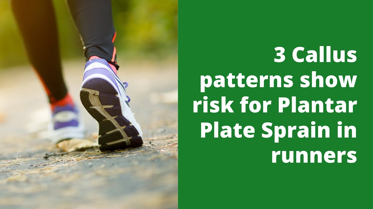 3 Callus patterns show risk for Plantar Plate Sprain in runners - YouTube