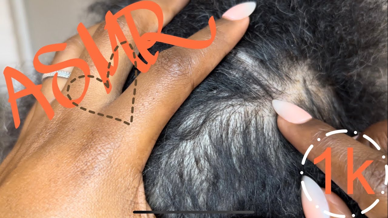 10 minute SCALP SCRATCH| Intense Scratching Sounds to help SLEEP🥱 - YouTube