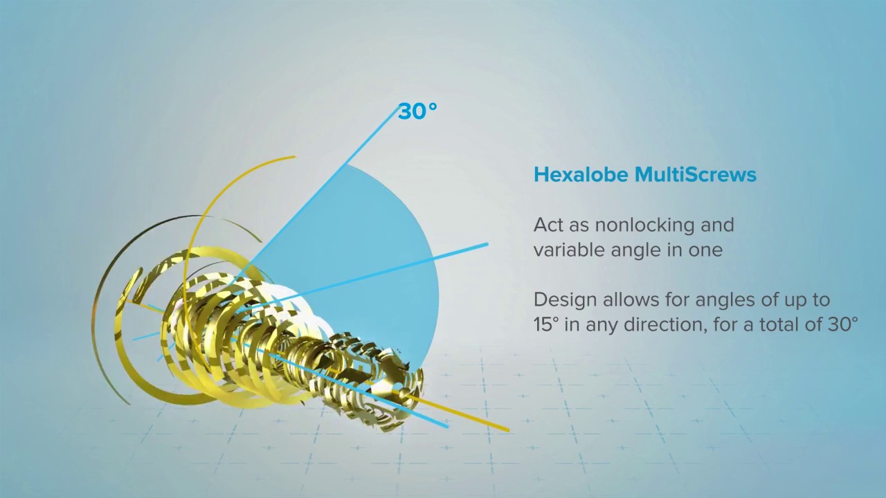 Acumed Hand Fracture System Overview - YouTube
