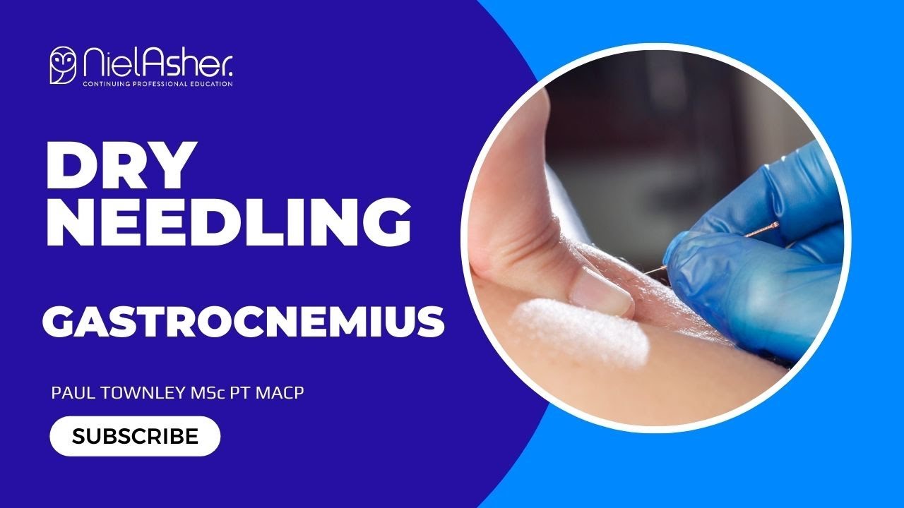 How to Perform Dry Needling on the Gastrocnemius Muscle - YouTube