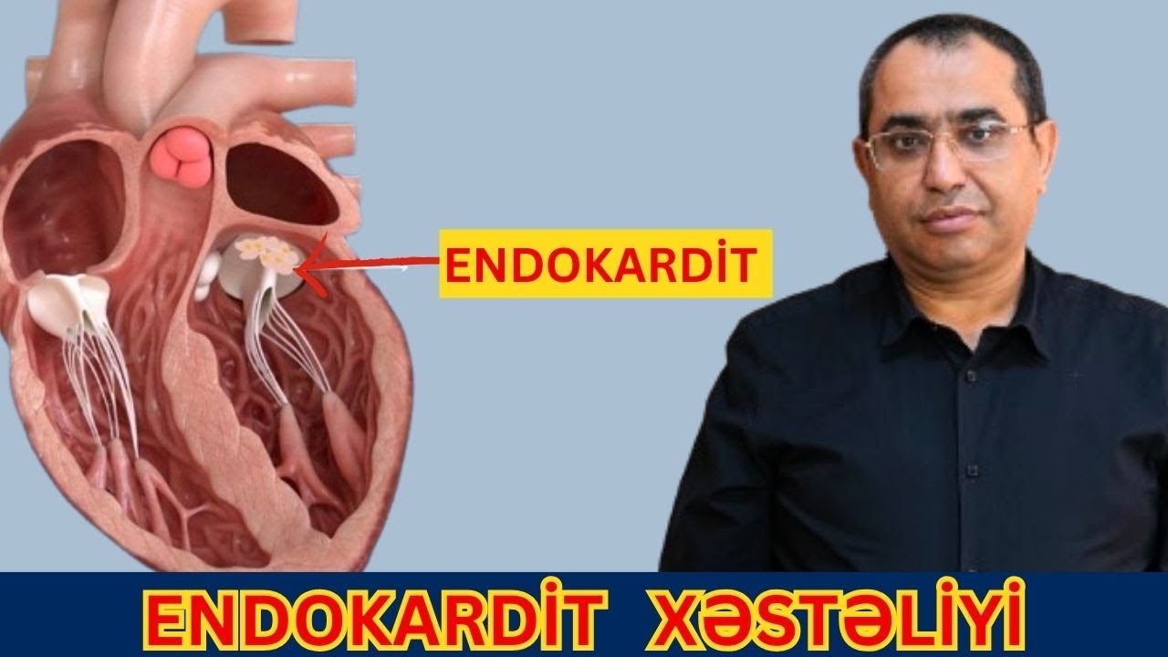 Uşaqlarda Boğaz və Diş İNFEKSİYASININ yaratdığı XƏSTƏLİK / ENDOKARDİT ...
