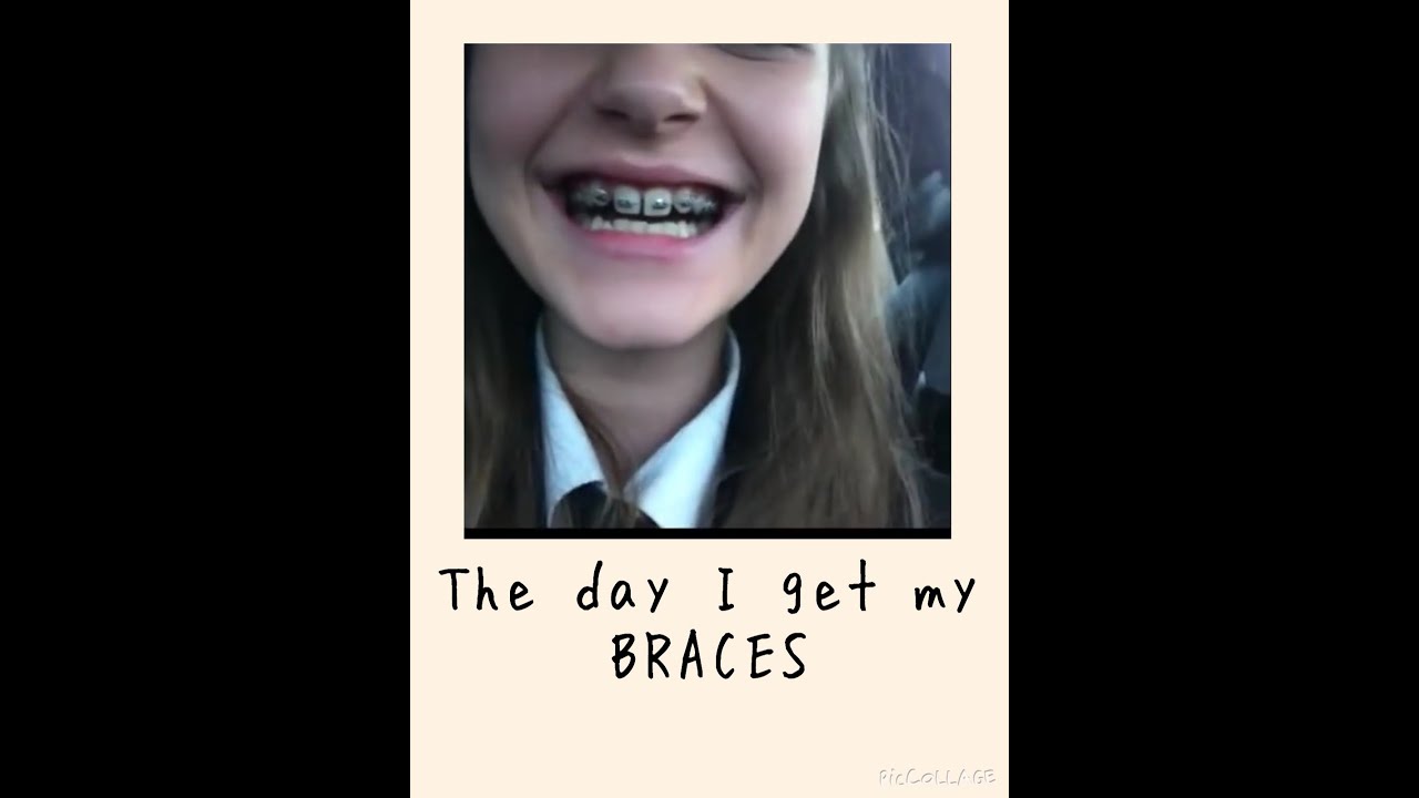 The Day I Get My Braces [ellie rose] - YouTube
