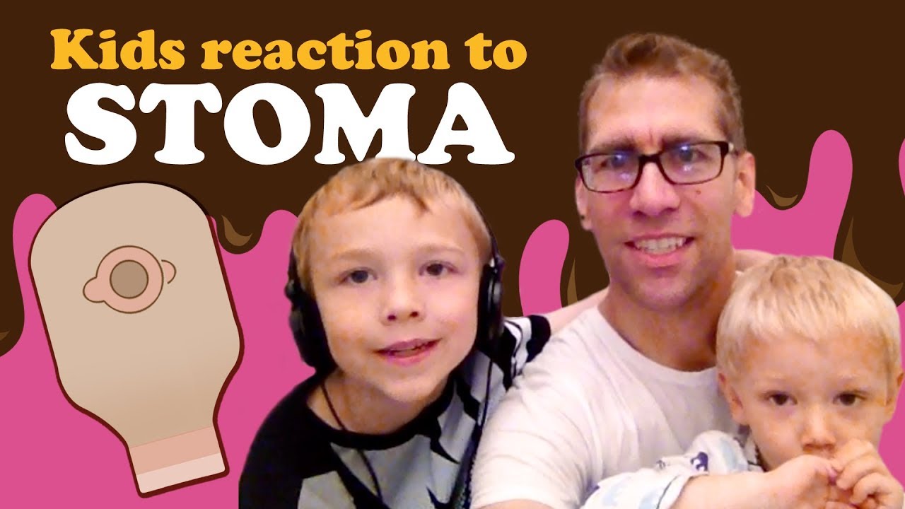Ileostomy bag and stoma reaction from kids - YouTube