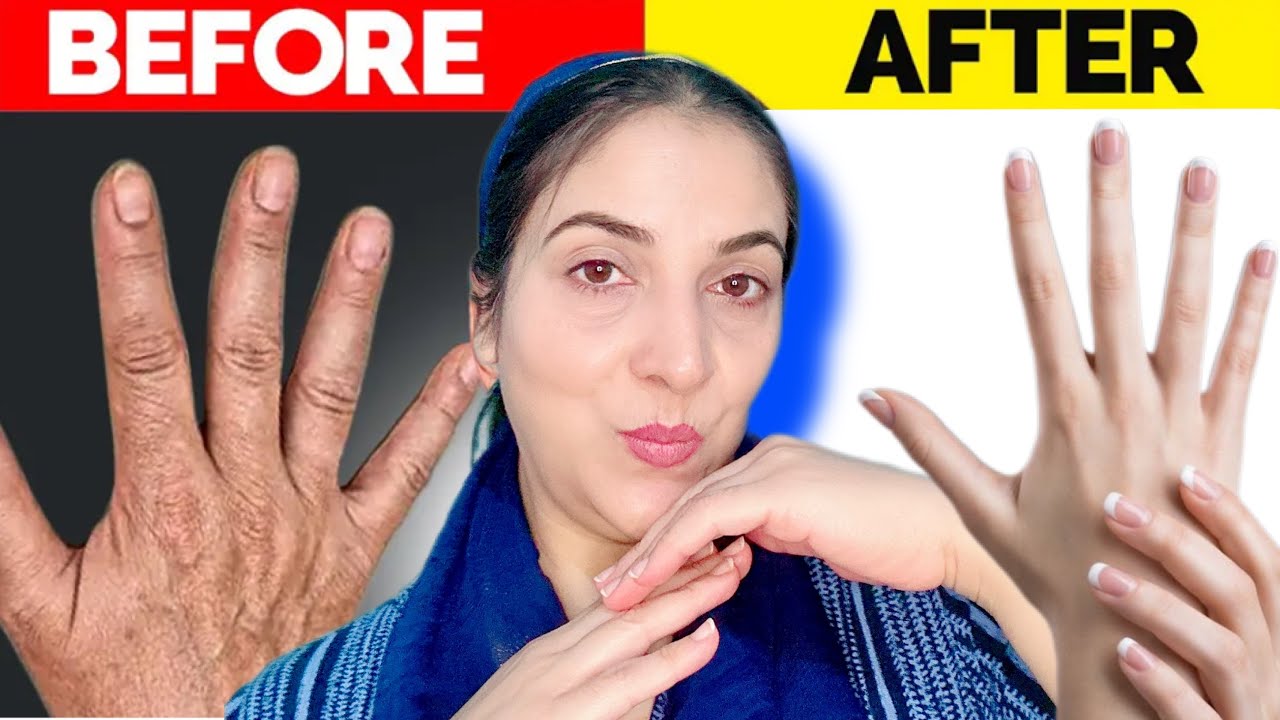 Hand Transformation !! Best Remedy For Hand Wrinkles And Sagging ...