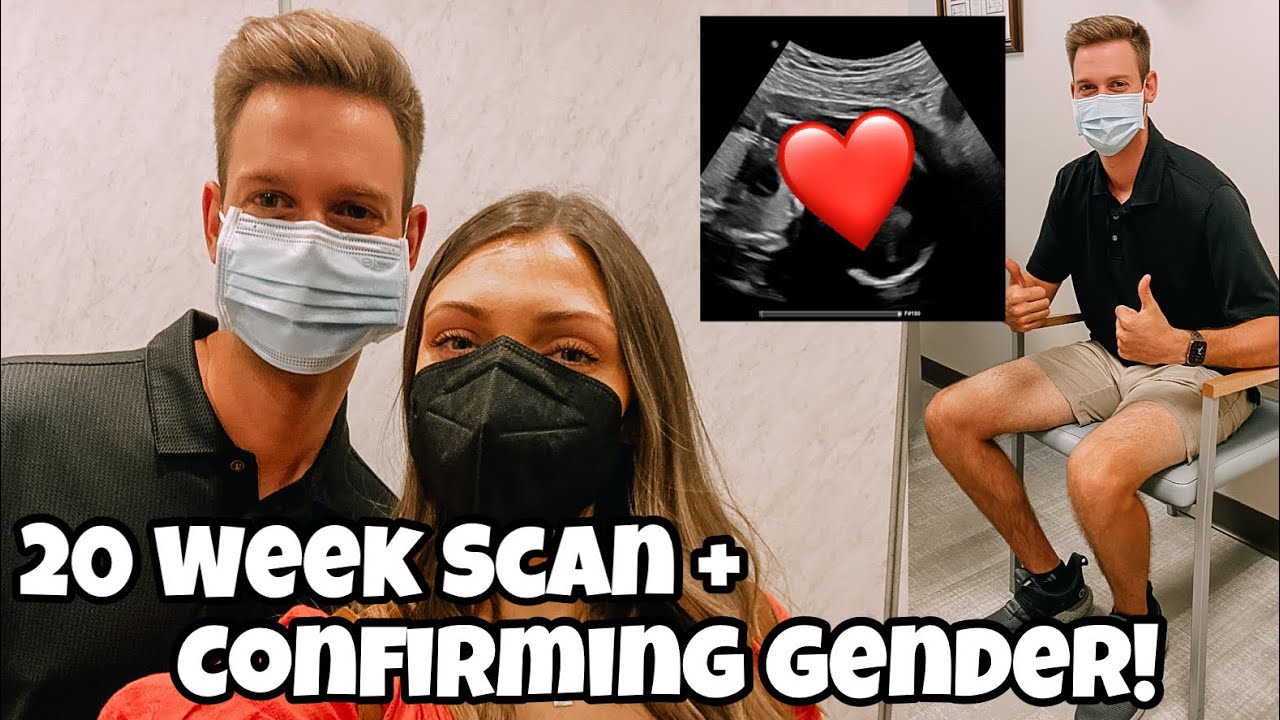 20 Week Anatomy Scan + Confirming Gender of Baby! | Boy or Girl?? - YouTube