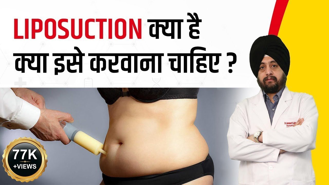 Liposuction For Weight Loss, Surgery Cost, Procedure, Side Effects, Tummy Tuck Abdominoplasty ...