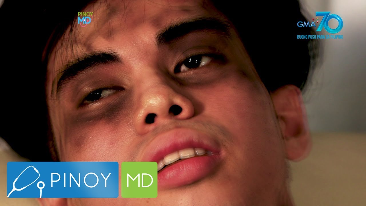 Pinoy MD: Ano ba ang masamang epekto ng kakulangan sa tulog at paano ...