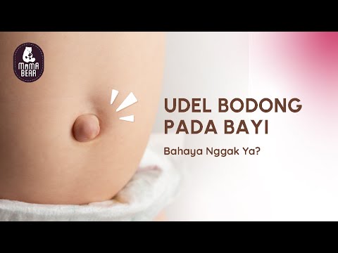 Udel Bodong Pada Bayi, Bahaya Nggak Ya?