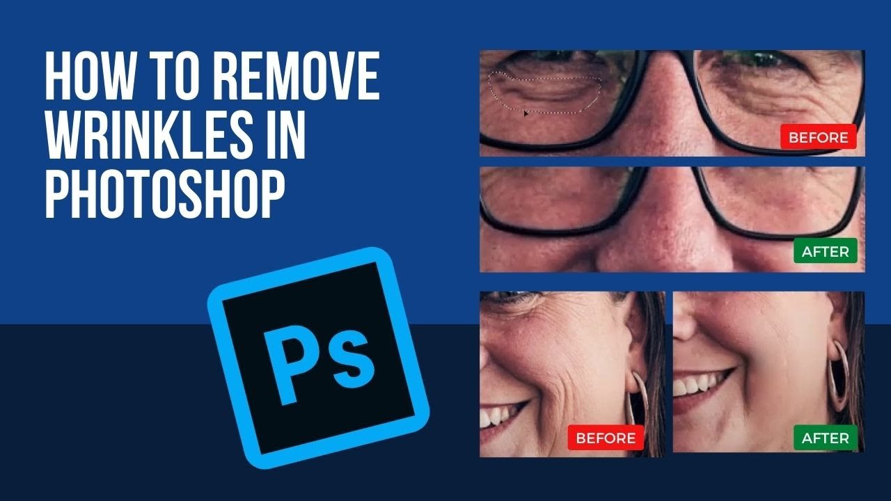 How To Remove Wrinkles In Photoshop YouTube how-to-remove-wrinkles-in-photoshop-youtube