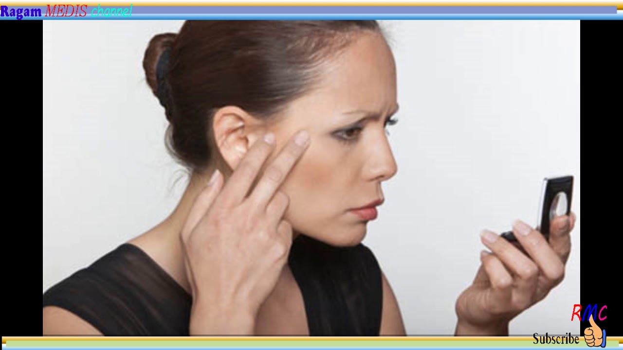 Cara Ampuh Menghilangkan Kutil di Wajah ternyata Sederhana - YouTube