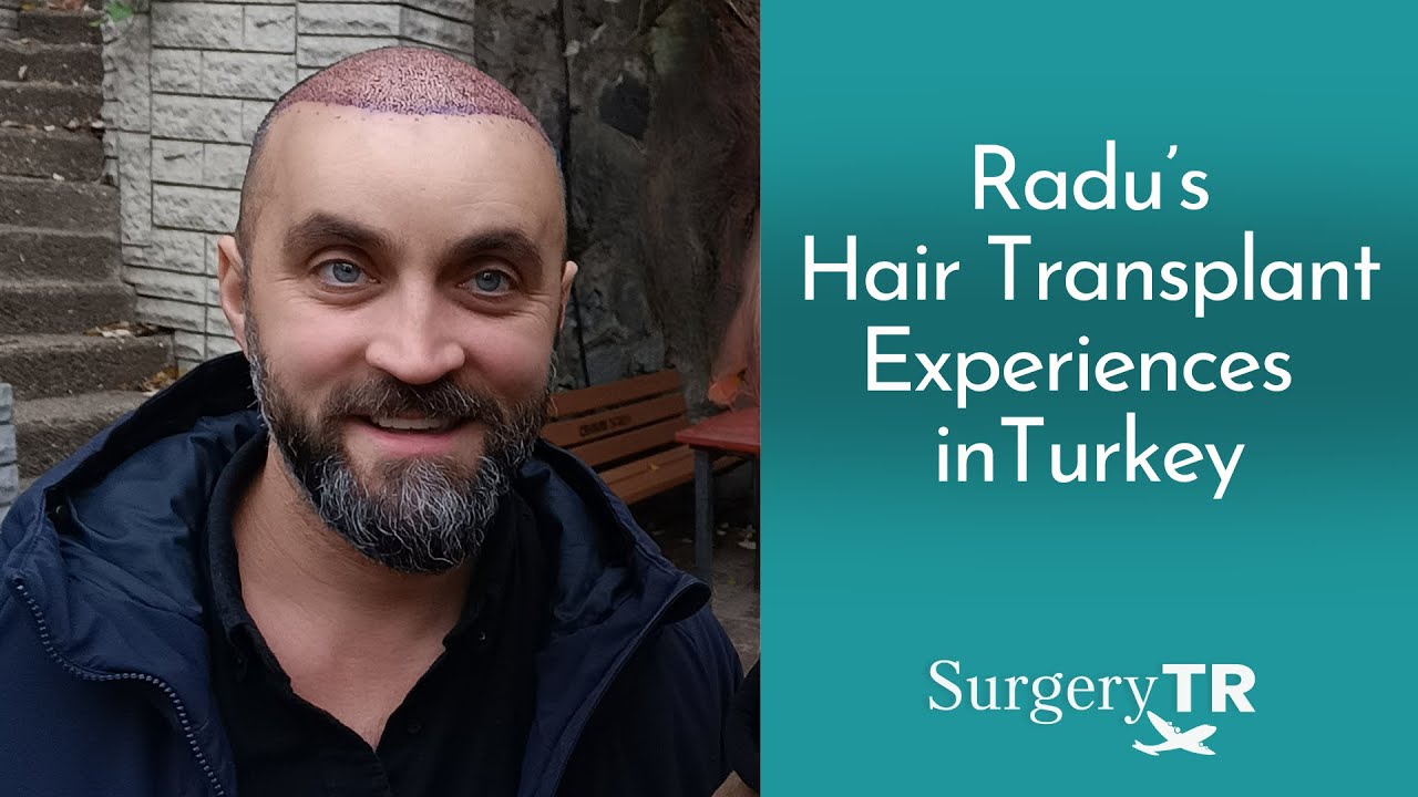 Hair Transplant | Radu's Experiences | SurgeryTR - YouTube