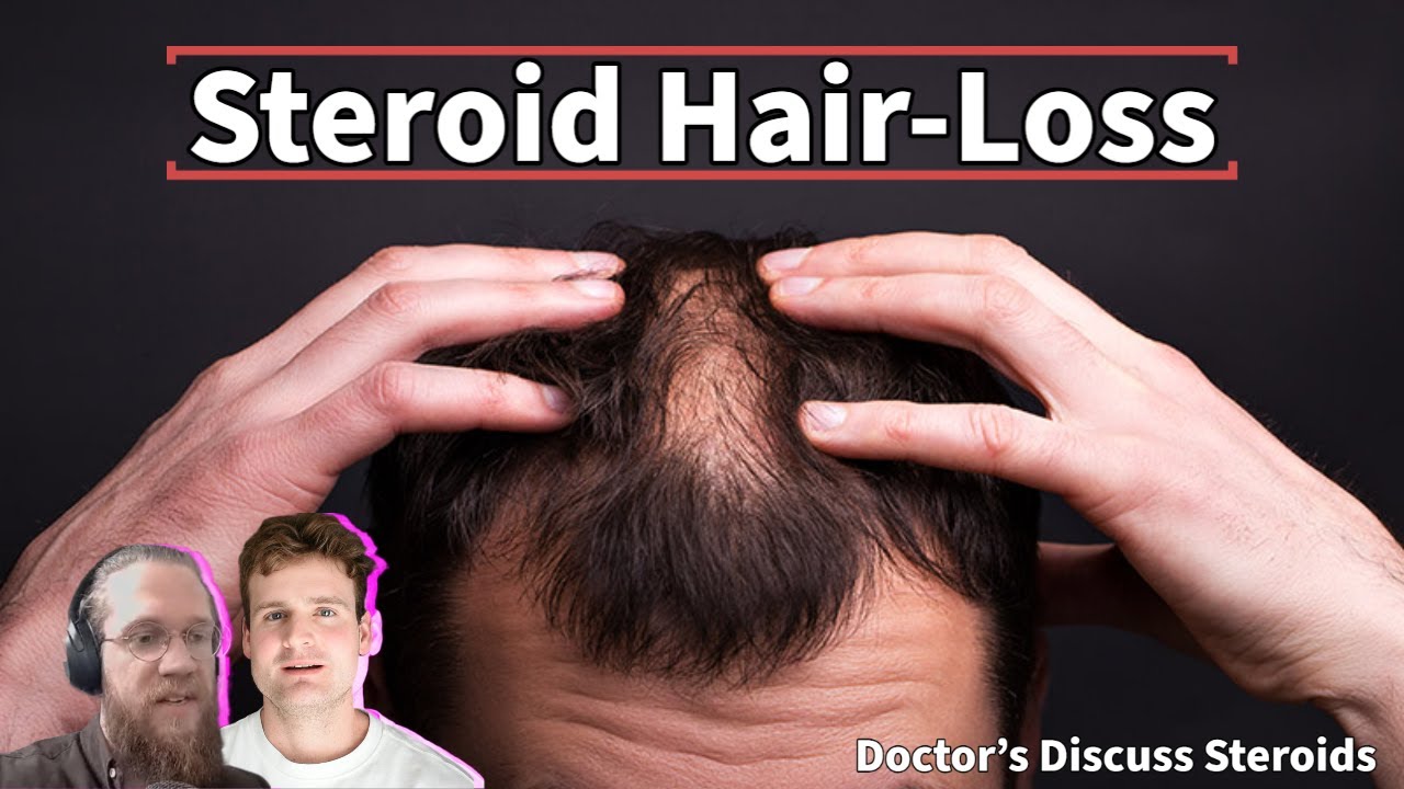 Hair Loss From Steroids? | Best Testosterone Dose? | Minoxidil | Doctor ...