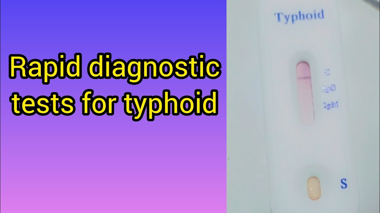 Rapid diagnostic tests for typhoid टाइफाइड के लिए त्वरित निदान परीक्षण ...
