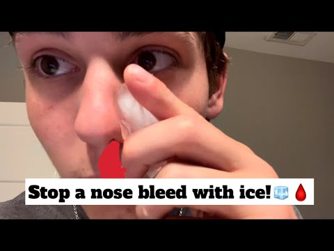 How To Treat A Nosebleed With Ice