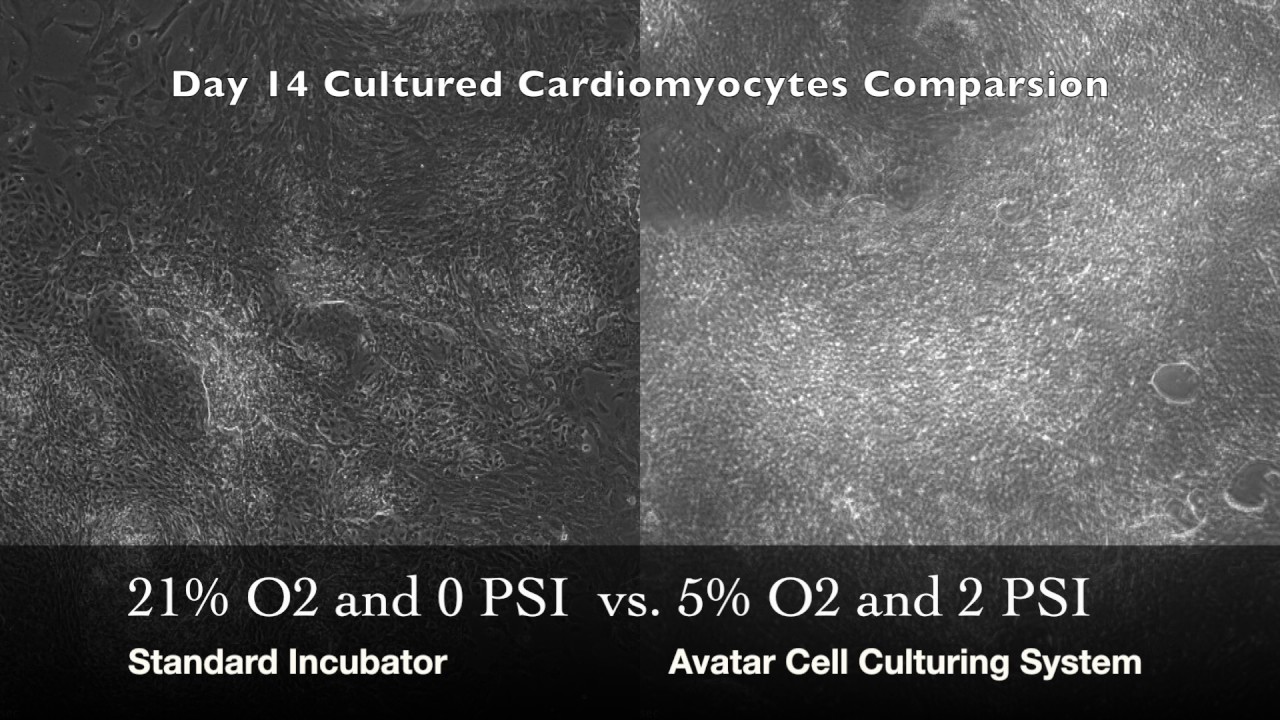Beating Cardiomyocytes Differentiated from iPSCs in Varying Oxygen and ...