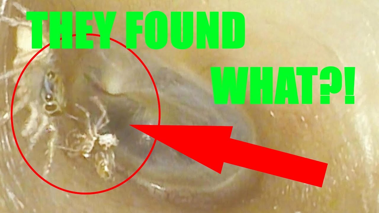 Doctors find spider crawling and shedding skin inside woman's ear - YouTube