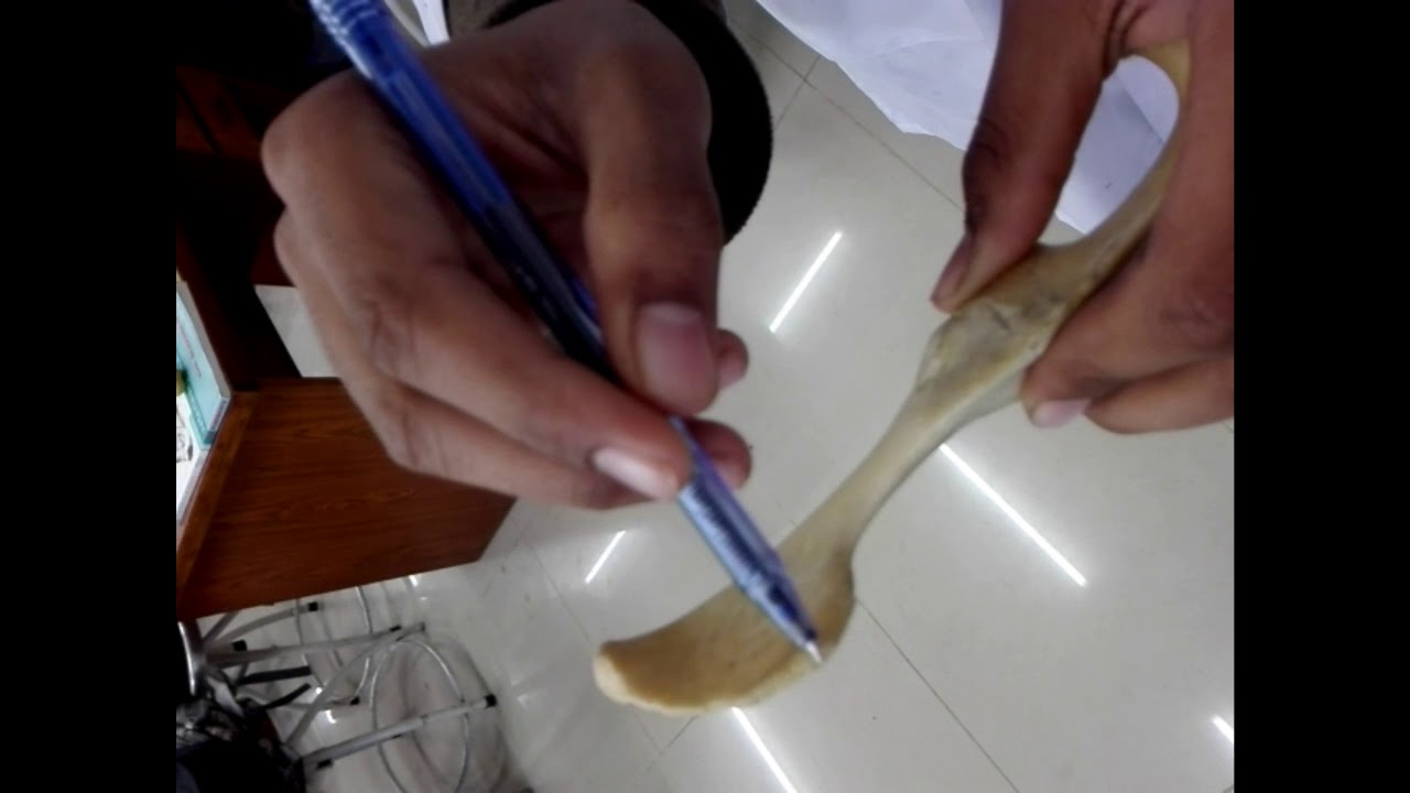 os coxae of goat - YouTube