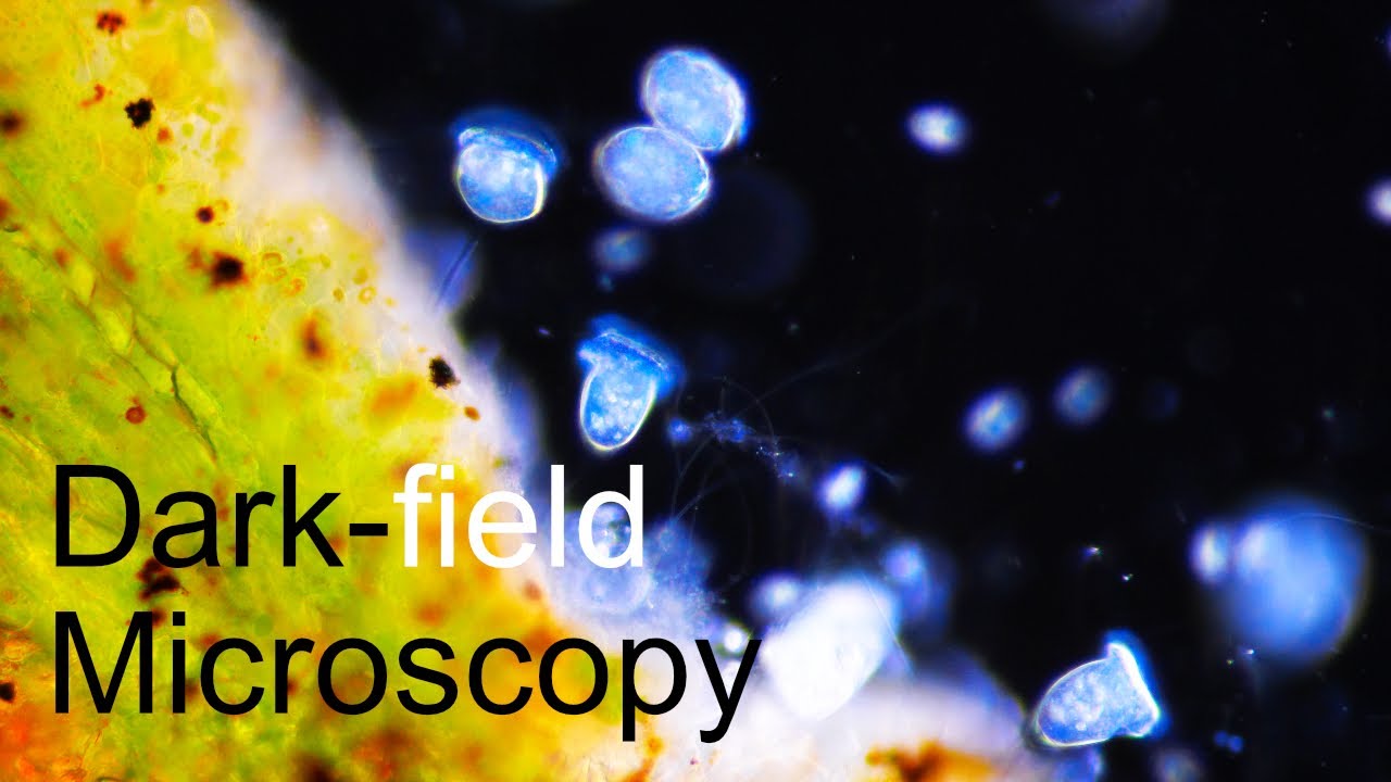 Dark-field Microscopy - YouTube