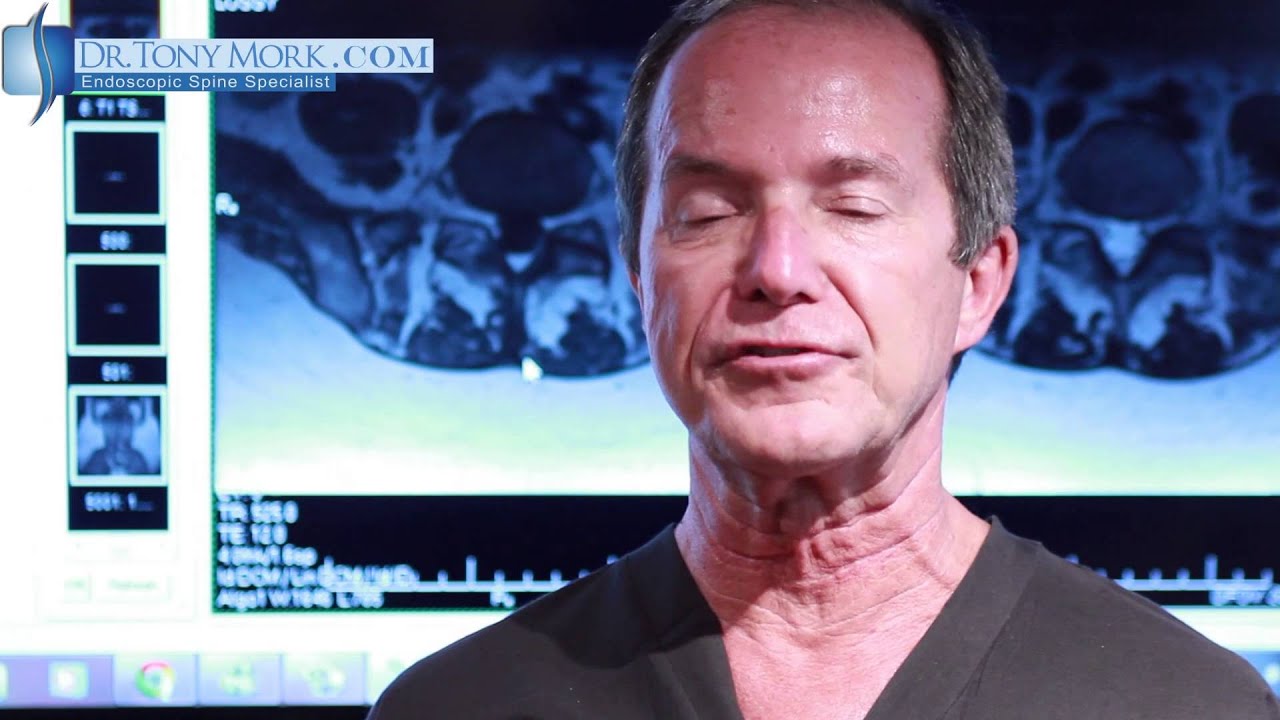 Spinous Process Syndrome Treatment by Dr. Tony Mork - YouTube
