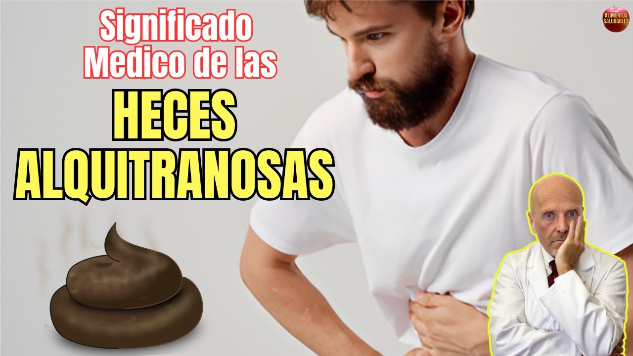 🆘 SIGNIFICADO DE LAS HECES ALQUITRANOSAS O MELENAS ¿QUE HACER SI TIENES ...