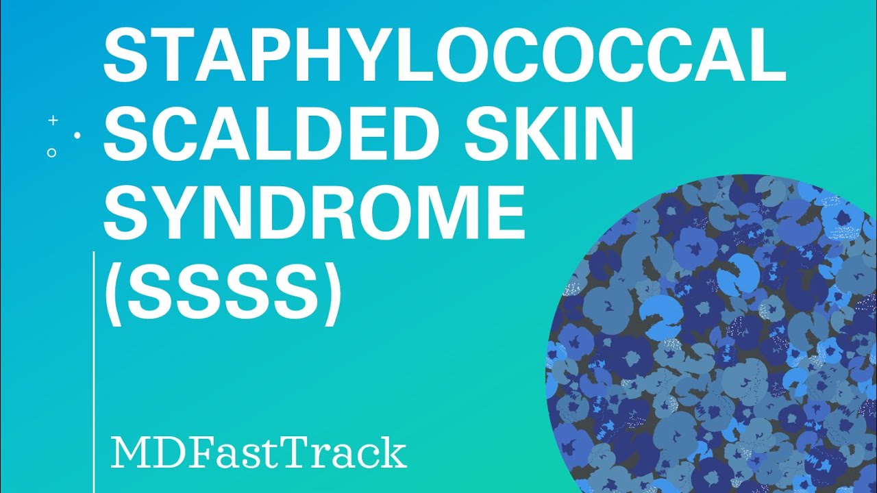 Staphylococcal Scalded Skin Syndrome (SSSS) [Med-School Lecture Series ...