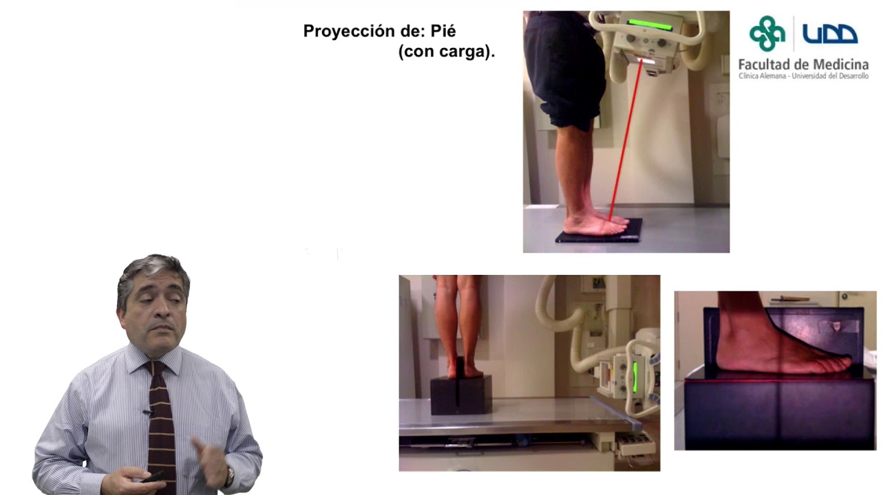 Técnicas Radiológicas Video Clase 5: Extremidad Inf s:b - YouTube