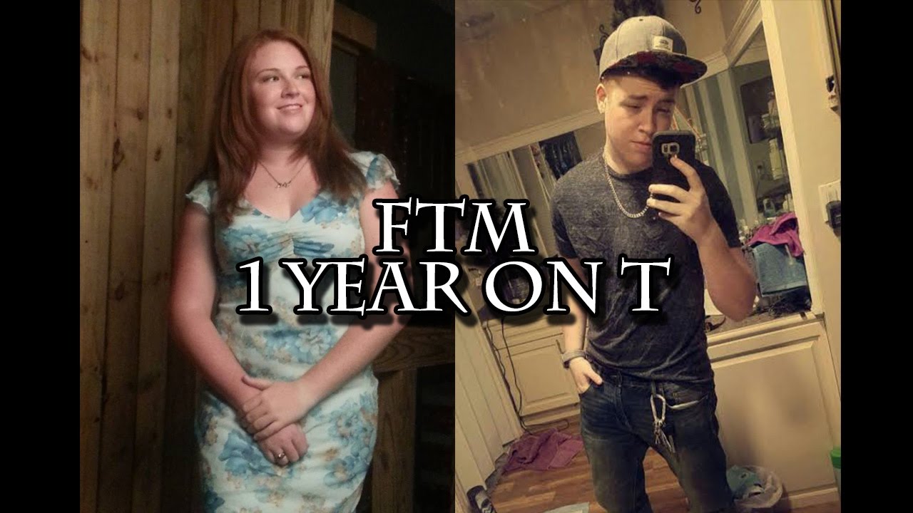 FTM - 1 year on Testosterone - YouTube