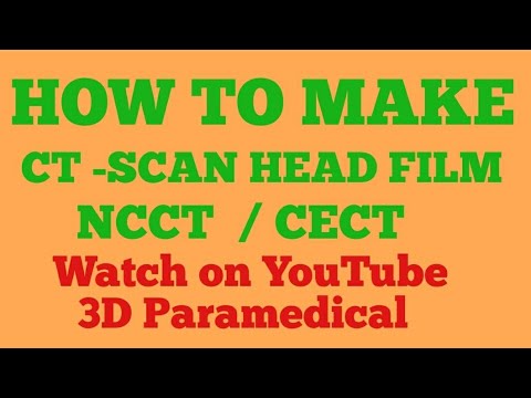How to make CT Scan NCCT HEAD FILM - YouTube