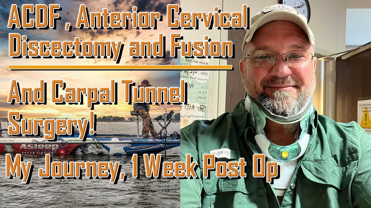 1 Week Post Op, ACDF Recovery Story And Carpal Tunnel Surgery! - YouTube