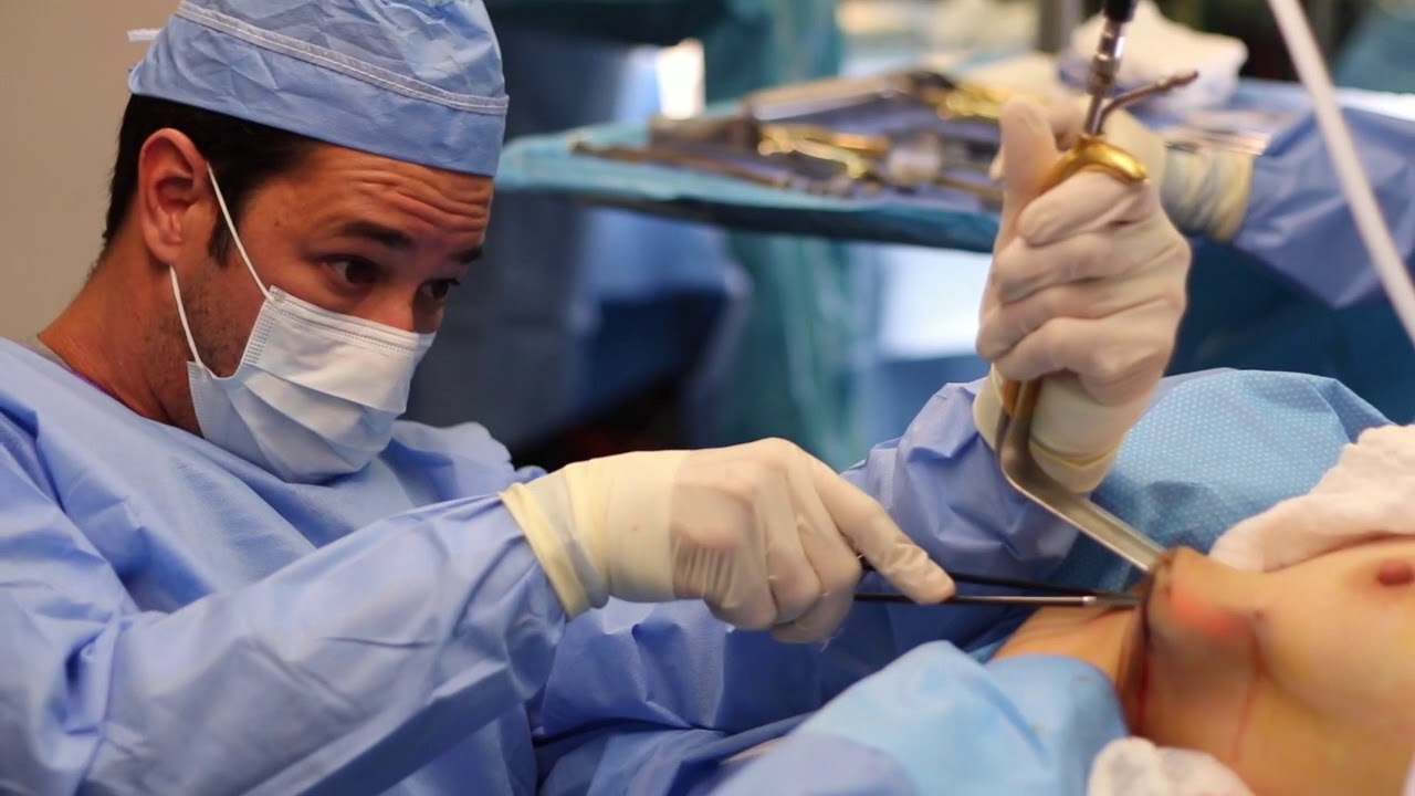 The Natural-Appearing, Scarless Cold-Subfascial Breast Augmentation ...