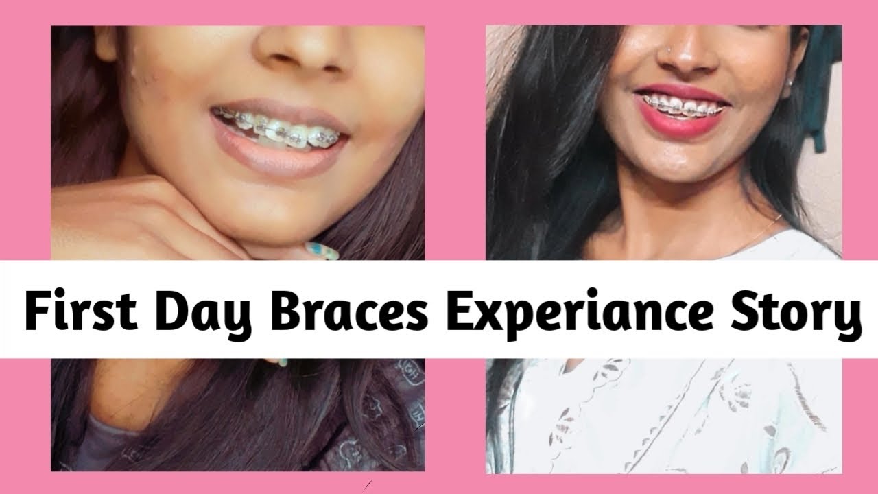 First Day Braces Experiance Story || First Day Scary Braces Experiance ...
