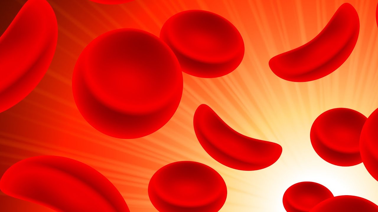 What is Sickle cell disease (SCD) l types,causes,symptoms, treatment l ...