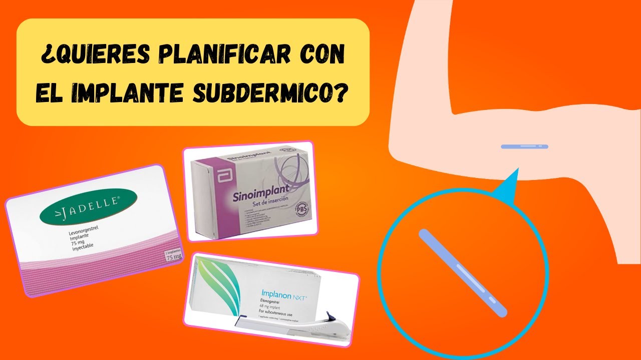 IMPLANTES SUBDÉRMICOS | Jadelle | Implanon | Sinoimplant - YouTube