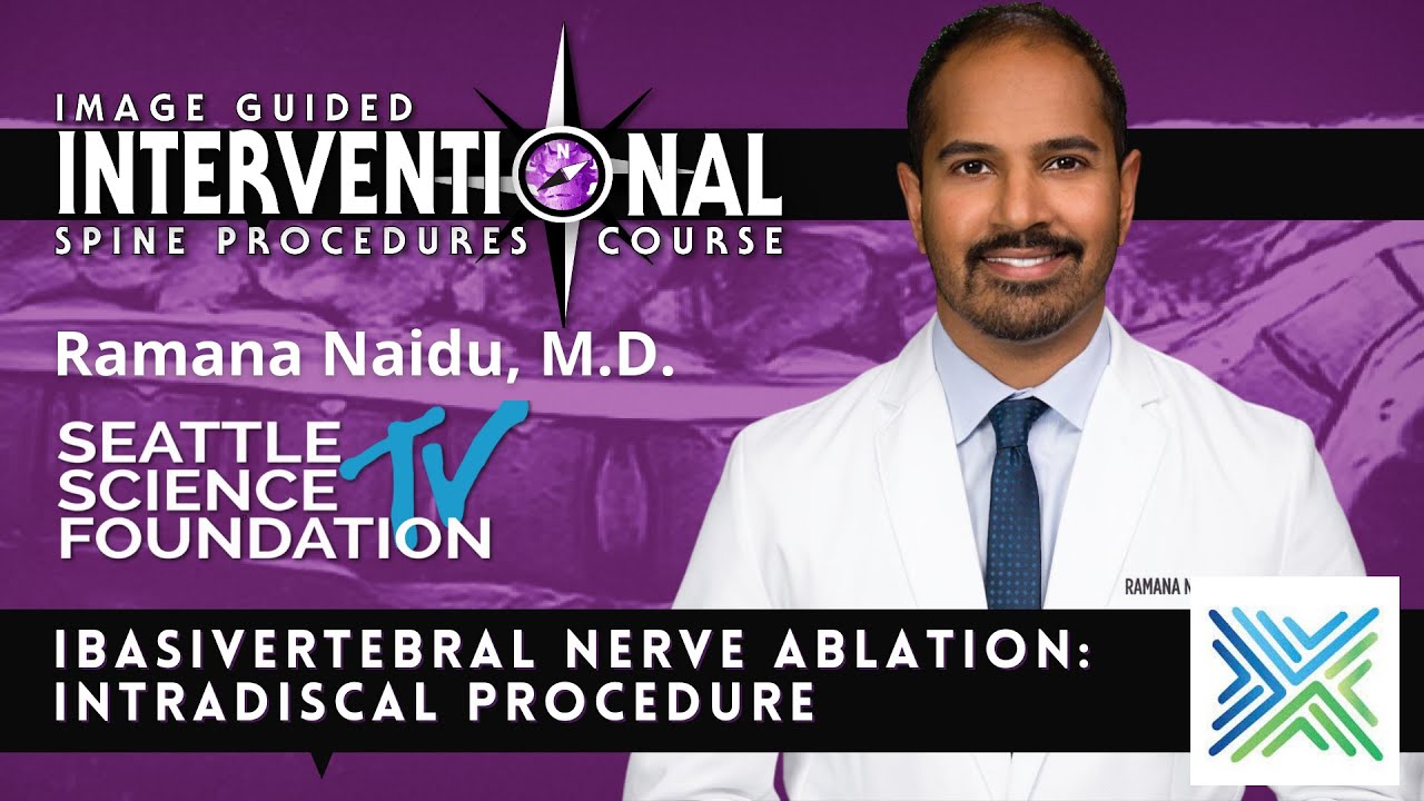 Basivertebral Nerve Ablation Intradiscal Procedure - Ramana Naidu, M.D ...