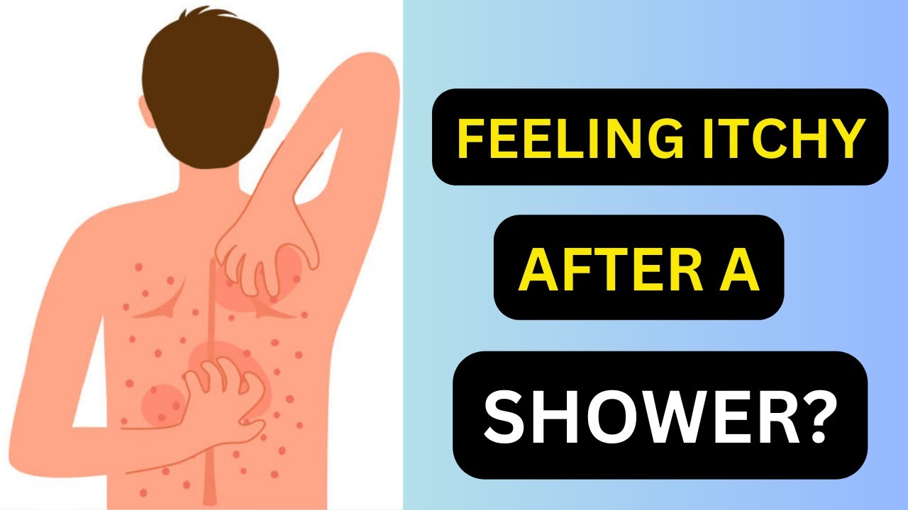 6 Reasons Why You Might Itch After a Shower - YouTube