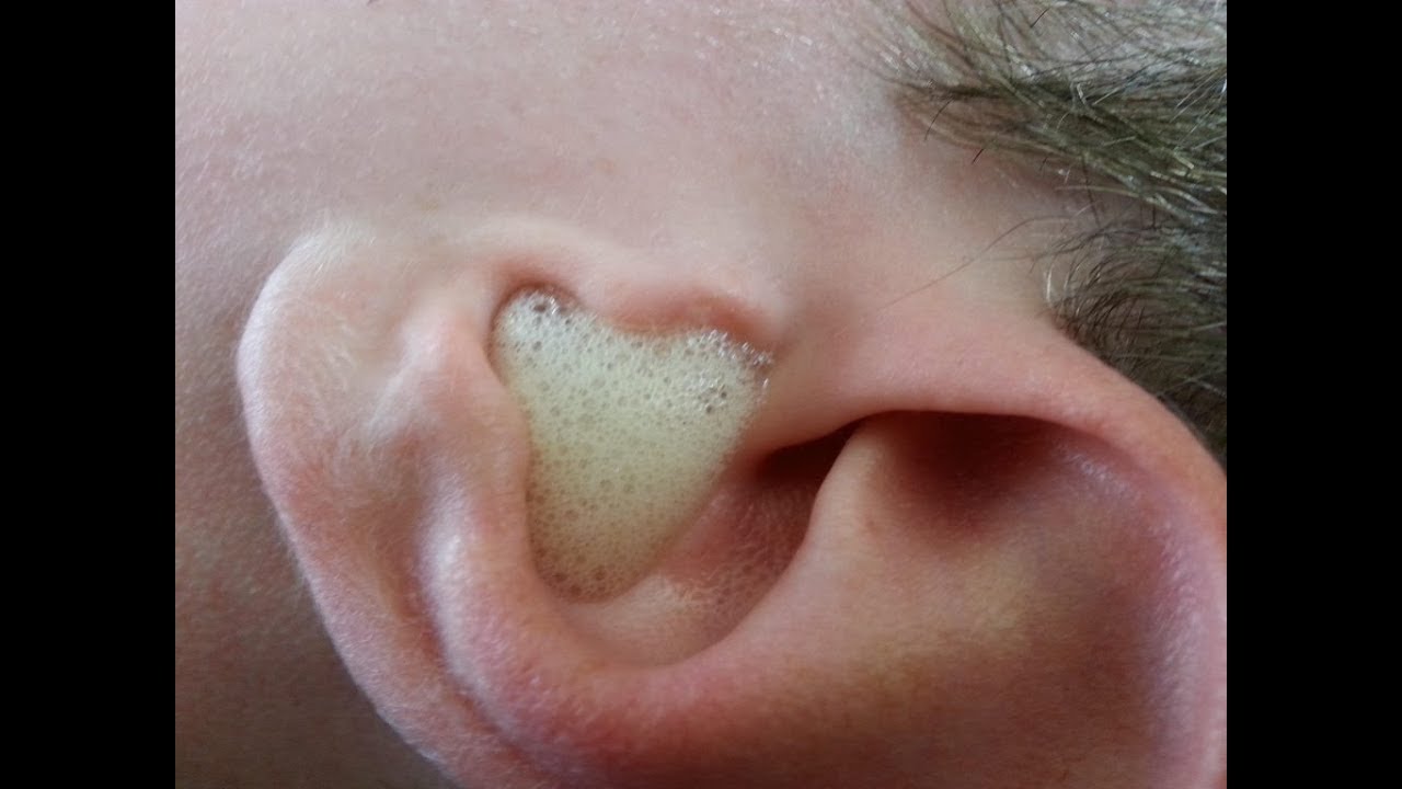 Eruption of a volcano in the ears - YouTube