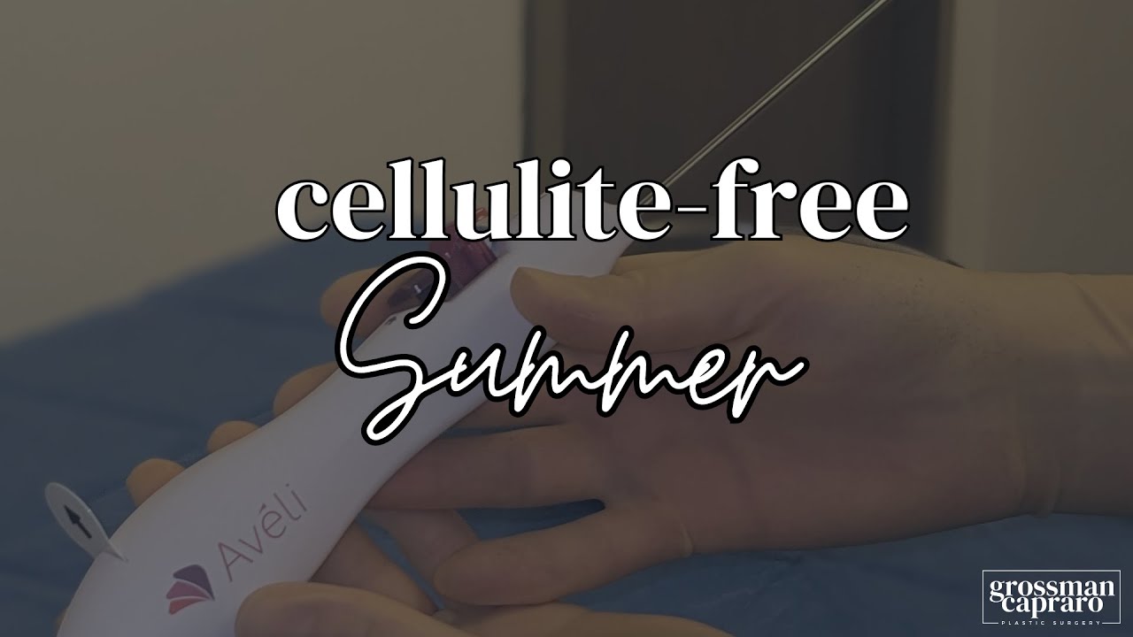 Cellulite-Free Summer Legs - YouTube